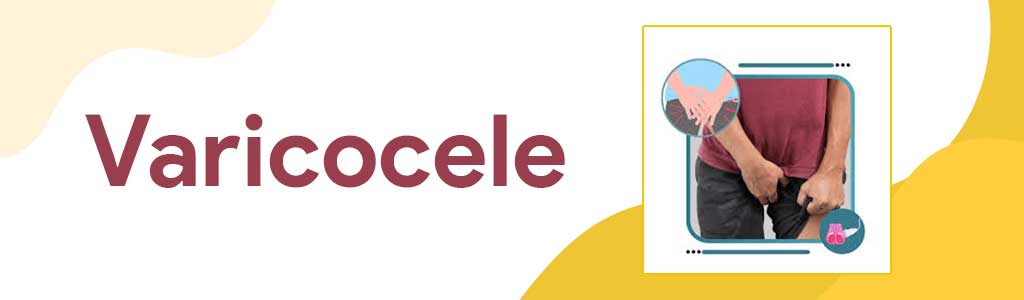Varicocele Treatment in Hyderabad | Surgery & Pain Relief – My Health ...